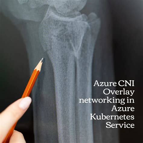 Create Bgp Peering Between Aks And Azure Virtual Wan With Cilium By Rick Jen Microsoft Azure