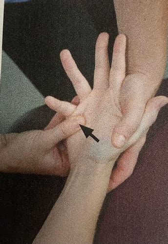 Hand MMT With Images Flashcards Quizlet