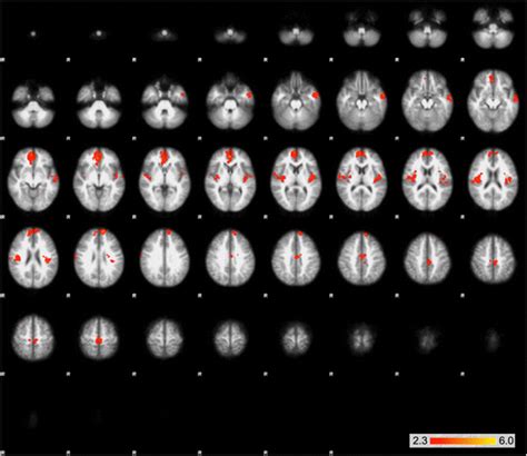 Large Clusters Of Activation That Were Significantly Greater In The Download Scientific Diagram