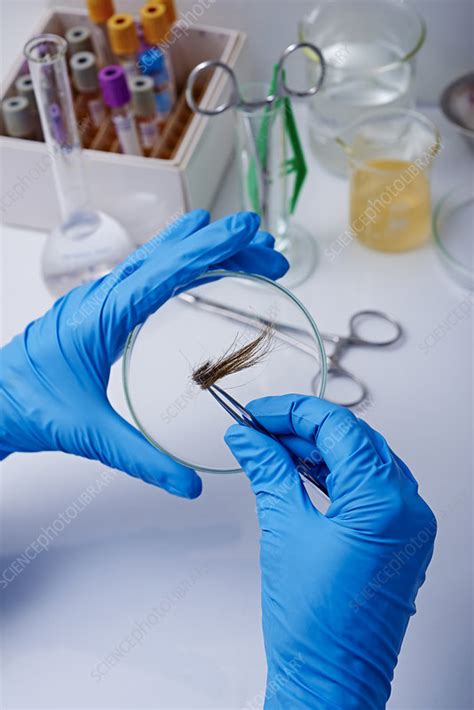 Biological Specimen Stock Image C0297830 Science Photo Library