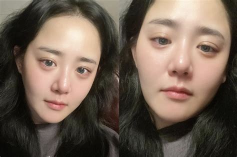 어쩐지 작품 뜸하더라 배우 문근영 살갗에 패인 흉터 드러내며 고백한 사연은