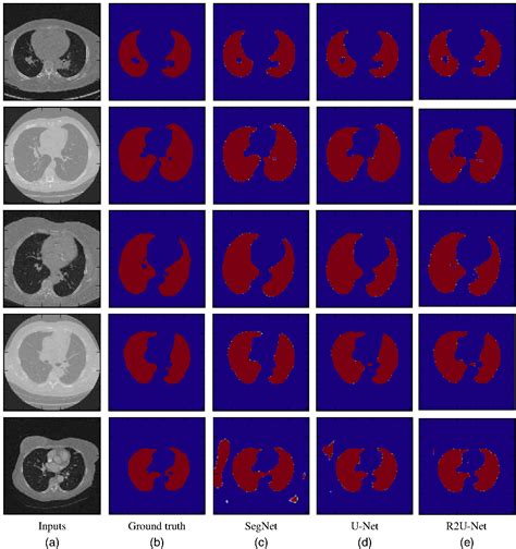 Recurrent Residual U Net For Medical Image Segmentation