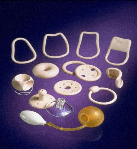 The Use Of Pessaries In Vaginal Prolapse European Journal Of Obstetrics And Gynecology And