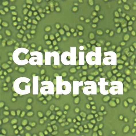 Everything You Need To Know About Candida Glabrata Yeastinfectionorg