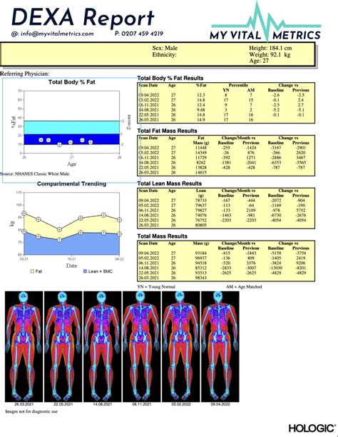How To Read A DEXA Scan The Food TeacherThe Food Teacher