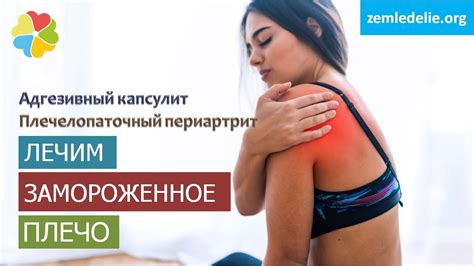 💯Рычаг решает Адгезивный капсулит Плечелопаточный периартрит как лечить Упражнения ЛФК