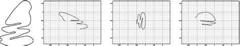 example of semi local affine invariant encoding the line on the left