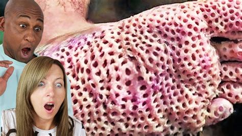 THE FEAR OF HOLES Trypophobia Test Watch If You Dare YouTube