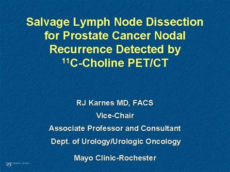 Salvage Lymph Node Dissection For Prostate Cancer Nodal