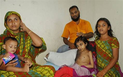 Now A 12 Year Old Bangladeshi Girl With Tree Man Syndrome World News