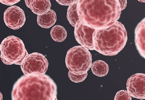 New Algorithm Helps Detect Aggressive Basal Cell Carcinoma For Optimal Treatment Prova Education