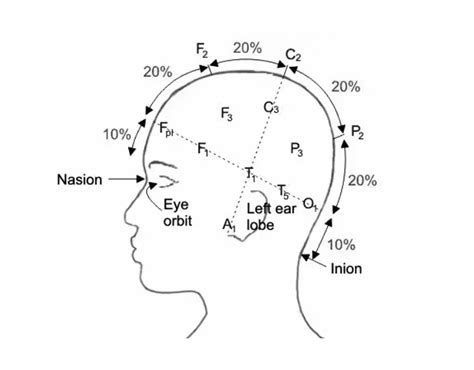 What Is A Brain Computer Interface Openbci