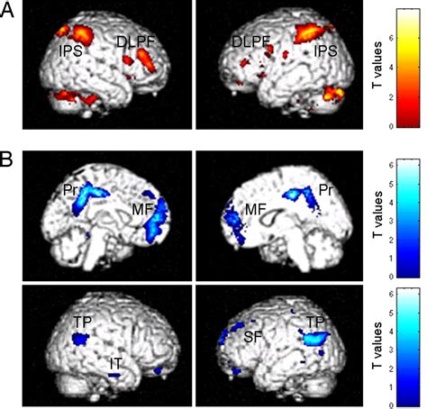 Baseline Brain Activity Fluctuations Predict Somatosensory Perception In Humans Pnas
