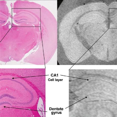 MR Imaging In A Mouse Model Of A Brain Tumor Showing A Different Download Scientific Diagram