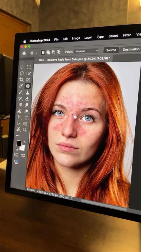 Remove Red Patches From Skin In Photoshop Artofit
