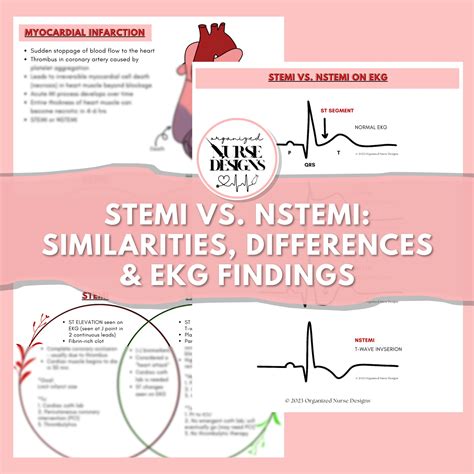 Cardiac Nursing School Study Guide Stemi Vs Nstemi Nursing School