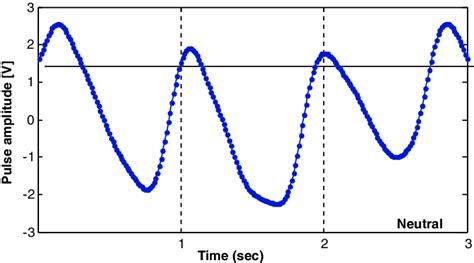 Segmented Vaginal Pulse Amplitude Signals In Neutral Class Recorded Download Scientific Diagram