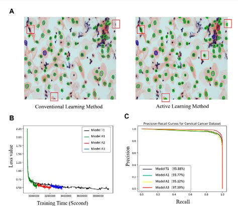 figure 1 from deep convolutional neural networks using an active learning strategy for cervical