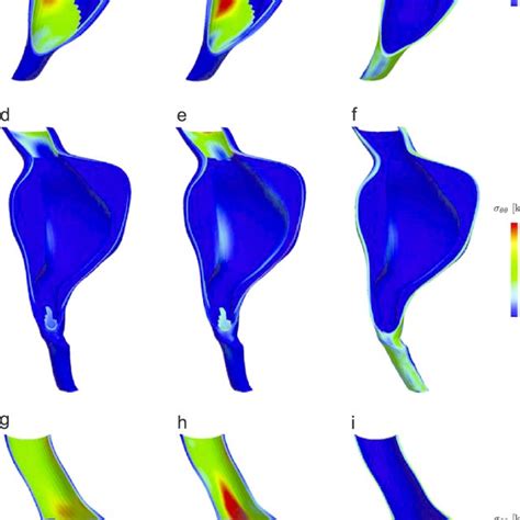 Representative Finite Element Simulations Showing The Distribution Of