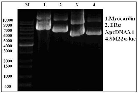 1 The Large Number Of Plasmid Extraction Download Scientific Diagram