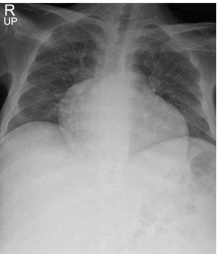 순환기계 Image3 Wip Flashcards Quizlet