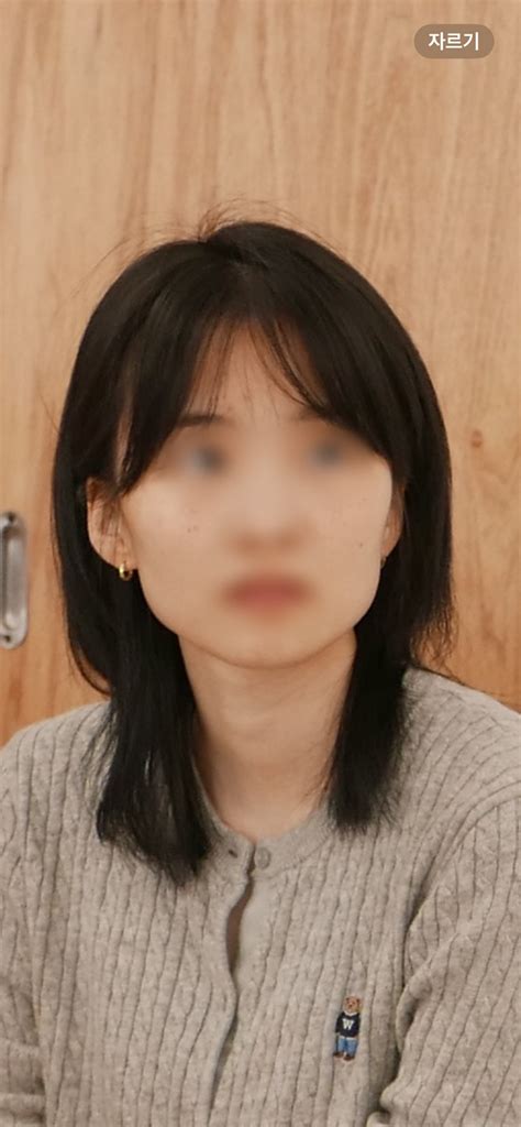 시술 수술 질문 안면 윤곽 너무 고 강남언니 1등 성형수술and피부시술 정보앱