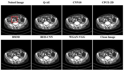 Comparison Of Different Deep Learning Methods For Denoising Low Dose Ct