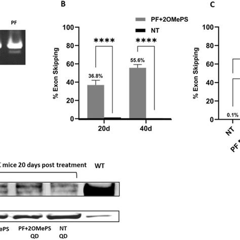 Exon Skipping And Dystrophin Expression A Representative Nested Pcr Of Download Scientific