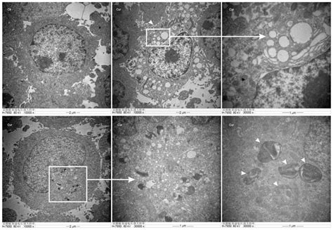 Autophagy Microscope