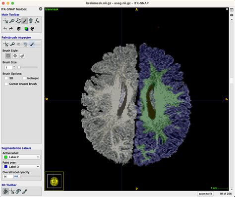 Itk Snap Tutorial 2 The Itk Snap Gui — Andys Brain Book 10 Documentation