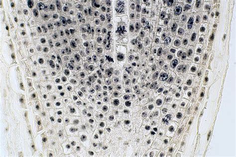 Root Tip Of Onion Show Mitosis Cell In The Root Tip Under Microscope View Stock Photo Image Of