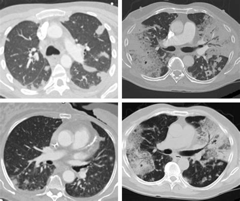 Ct Quick Guides Ct Scanning