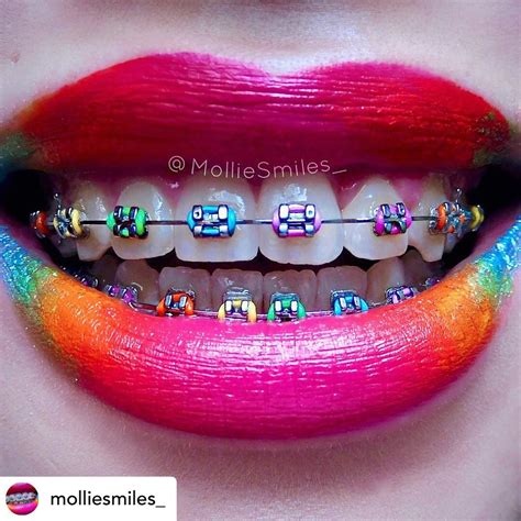 Carousel How Freaking Cool Is This 😎🤩 ️🧡💙💋 Rainbow Braces We Can