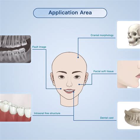 Flow Chart Of The Cbct 3d Reconstruction Download Scientific Diagram
