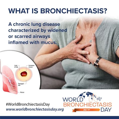 Worldbronchiectasisday Bronchiectasis Healthylungs Lunghealth Global Allergy And Airways