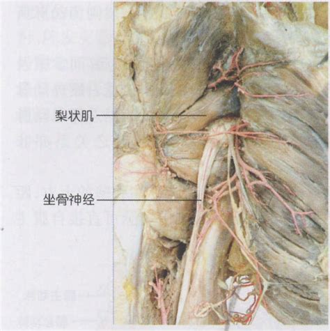 骨盆侧壁肌 钟世镇现代临床解剖学 医学