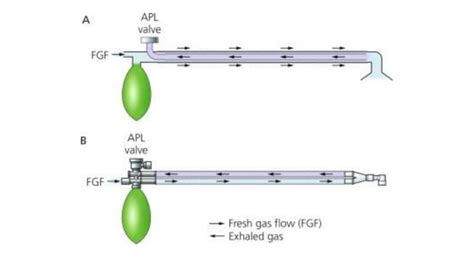 Breathing Systems Mapleson Classification Pdf