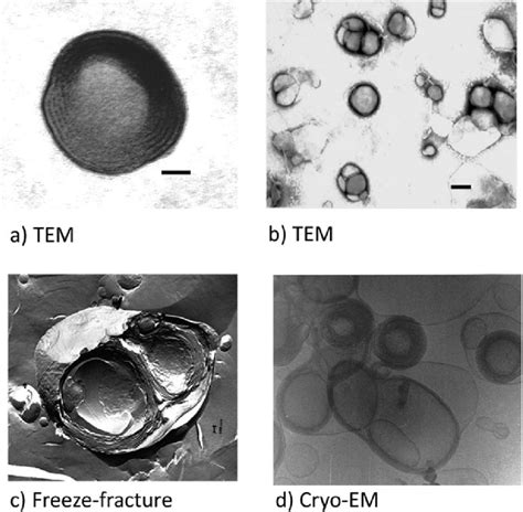 Multilamellar Vesicles Imaged Using Various Em Systems Multiple Download Scientific Diagram