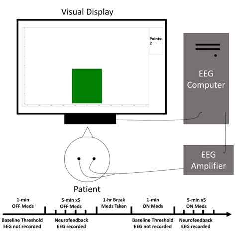 Research Peter Tass Lab Stanford Medicine