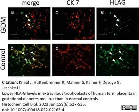 Anti Human Hla G Antibody Clone Mem G9 Bio Rad