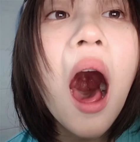 Asian Girl Uvula Video ThisVid Com Asian Girl Uvula Video ThisVid Com