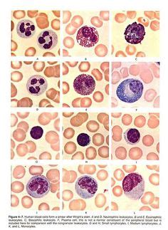 Atlas De Hematología Equinocitos Hematología Eritrocitos Ciencia