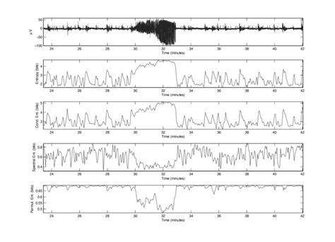 21 The Sample Eeg F3 C3 And The Shannon Entropy Conditional Download Scientific Diagram 21 The Sample Eeg F3 C3 And The Shannon Entropy Conditional Download Scientific Diagram