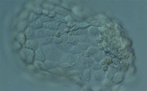 Figure Hatching Blastocyst Grade With Many Cells Some Of Variable Size Making Up A