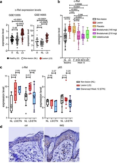 Targeting C Rel And Tlr7 A New Pathway For Psoriasis Treatment