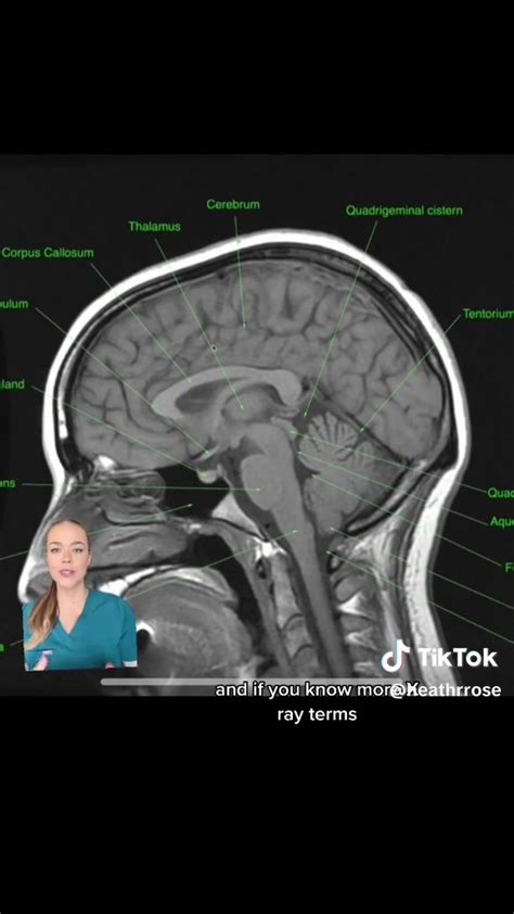 We Are Currently Live On The Pulse Radiology Mri Live Registry Prep This Prep Was Created To