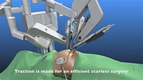 Levita Magnetics Announces Worlds First Magnetic Scarless Robotic