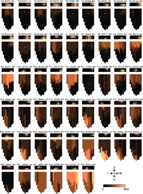 Individual Flatmaps Of Por With Injection Sites And Mec With