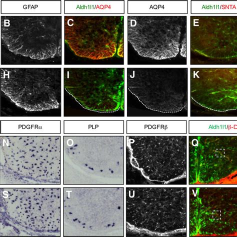 Asef Regulates Astrocyte Differentiation In Developing Spinal Cord Download Scientific Diagram