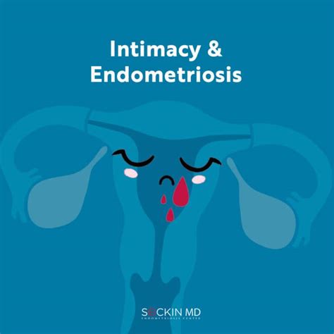 Sex And Endometriosis Seckin Endometriosis Center